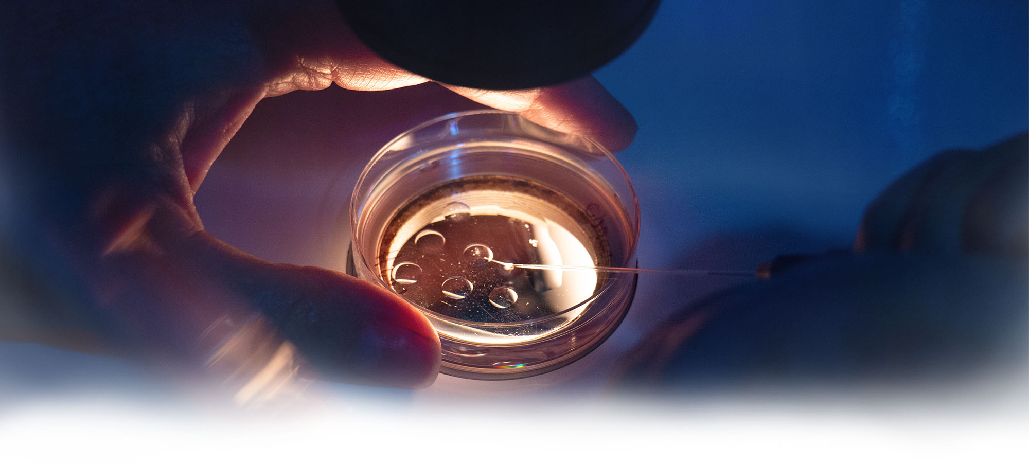 Andrology Laboratory Abnormal Sperm Morphology Treatment